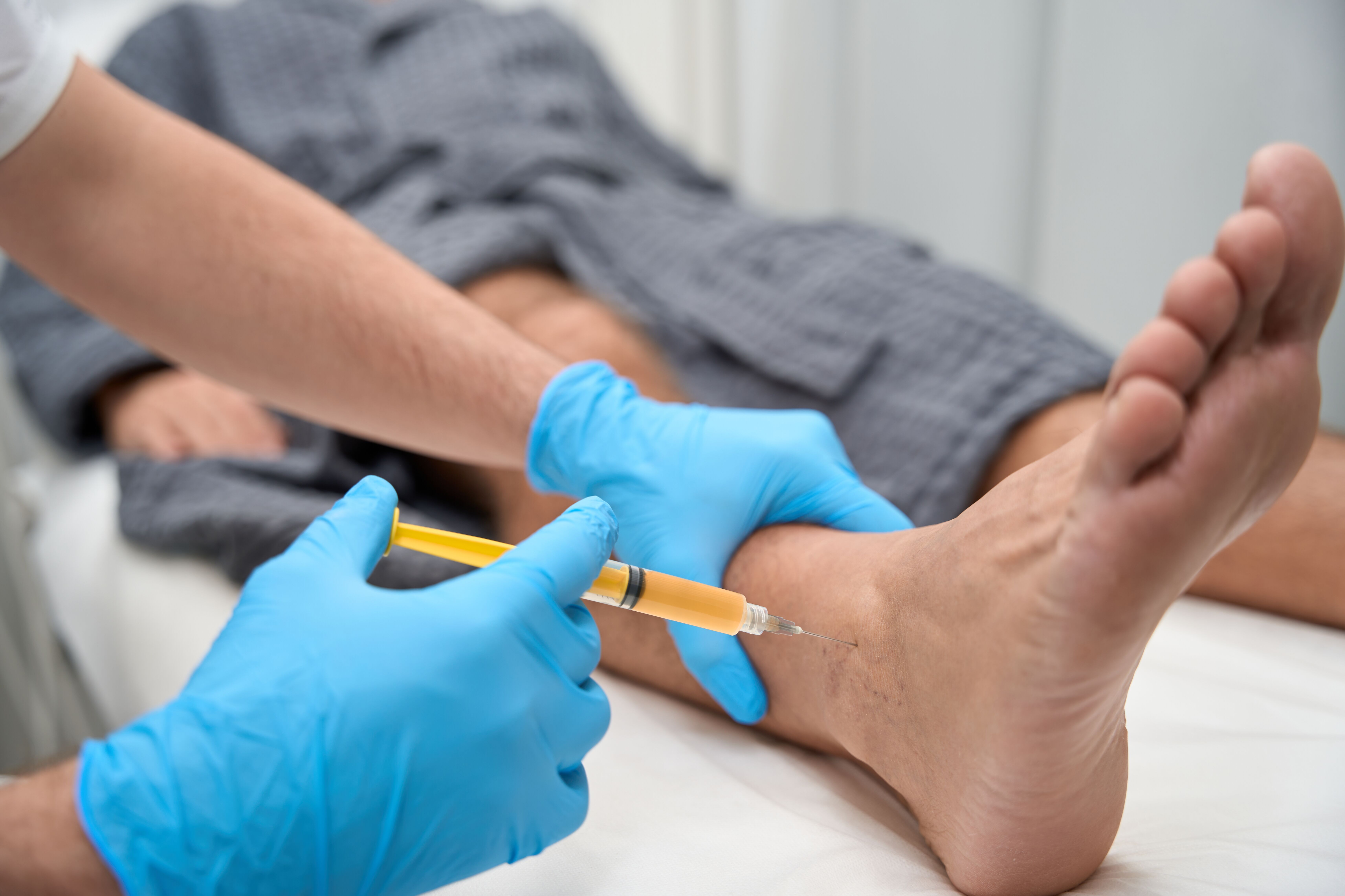 Stem Cell Therapy for Ankle Pain - RegenOrtho
